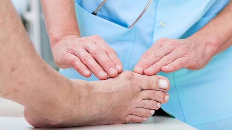 Spur on the toe pictures | Symptoms and pictures